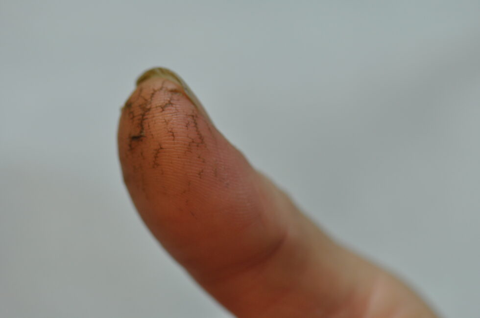Mechanic’s hands | ARA