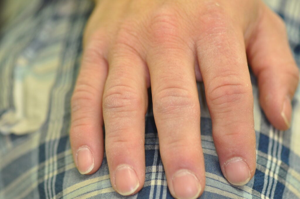 Mechanic’s hands | ARA
