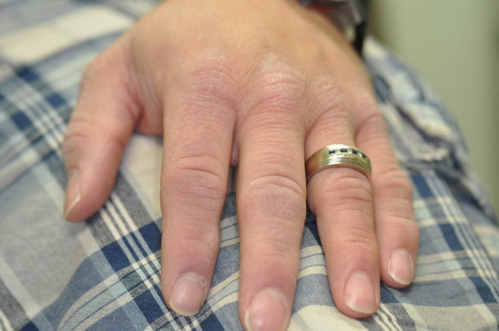 Mechanic’s hands | ARA